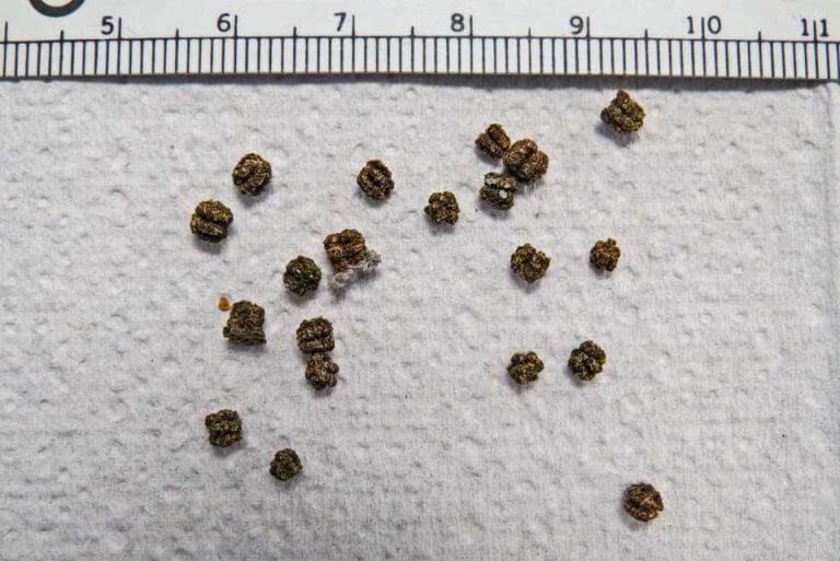 How to Handle the "Poopy Balls" of Life | Take Back Your Temple ...